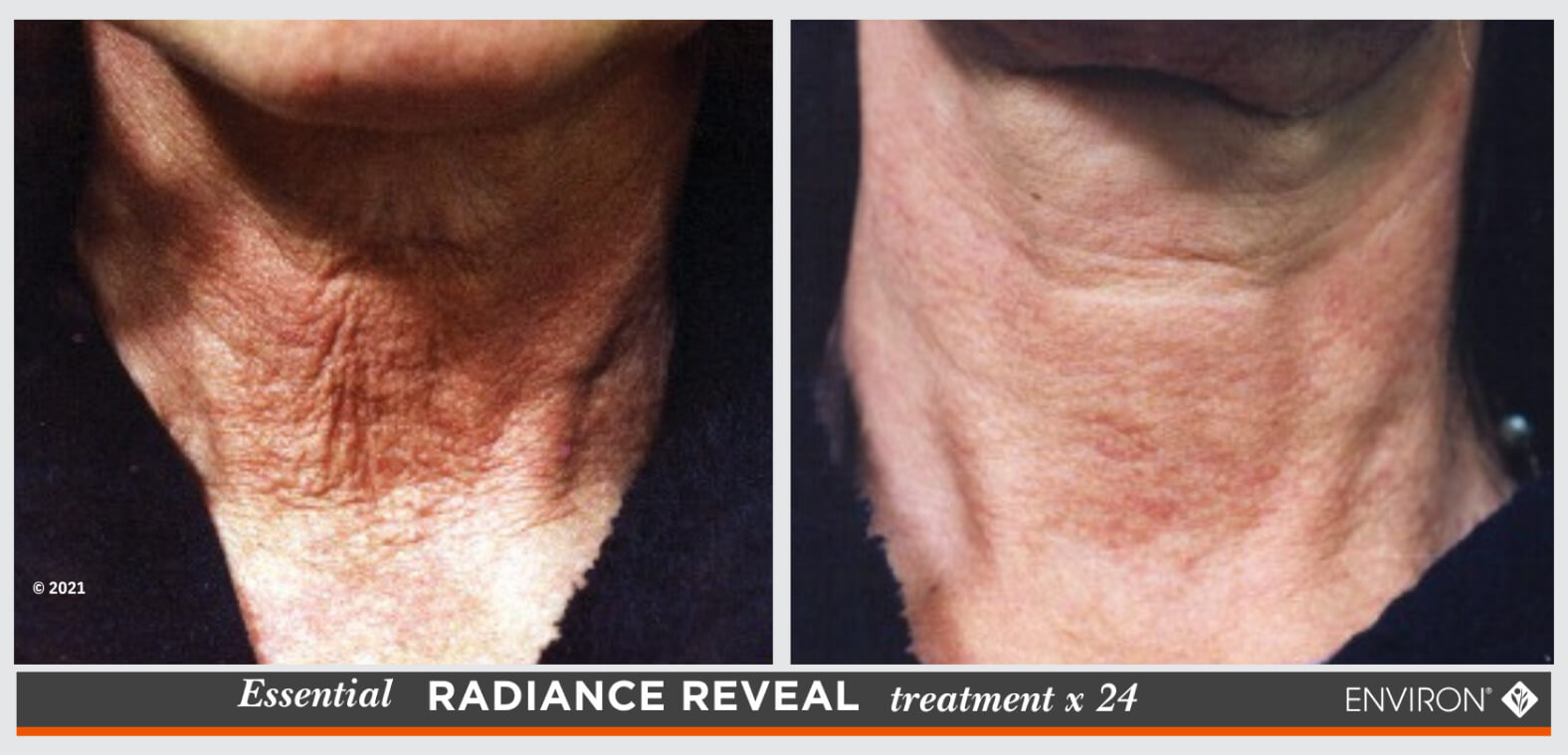 Environ® Electro-Sonic Ionzyme DF Machine III | Canada