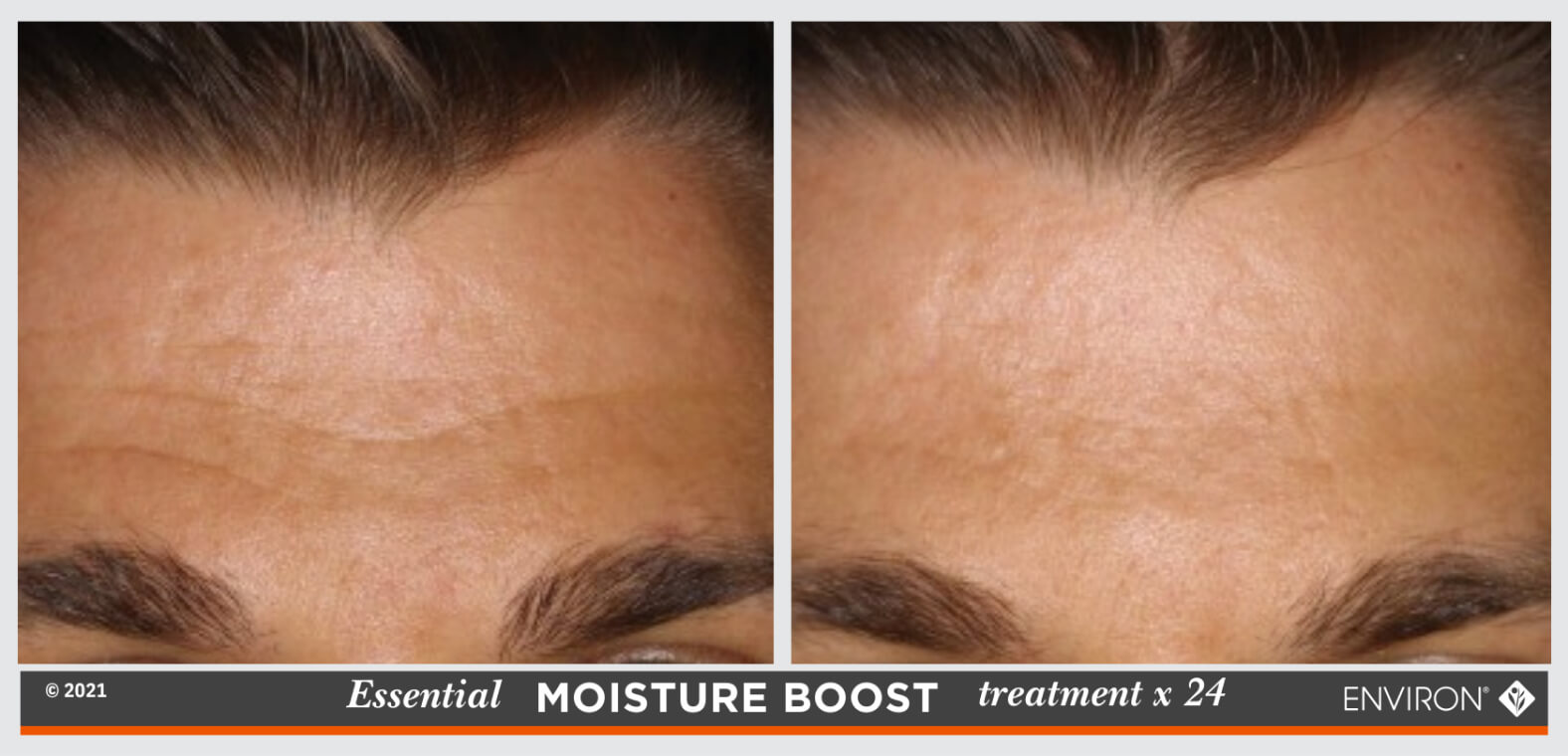 Environ® Electro-Sonic Ionzyme DF Machine III | Canada