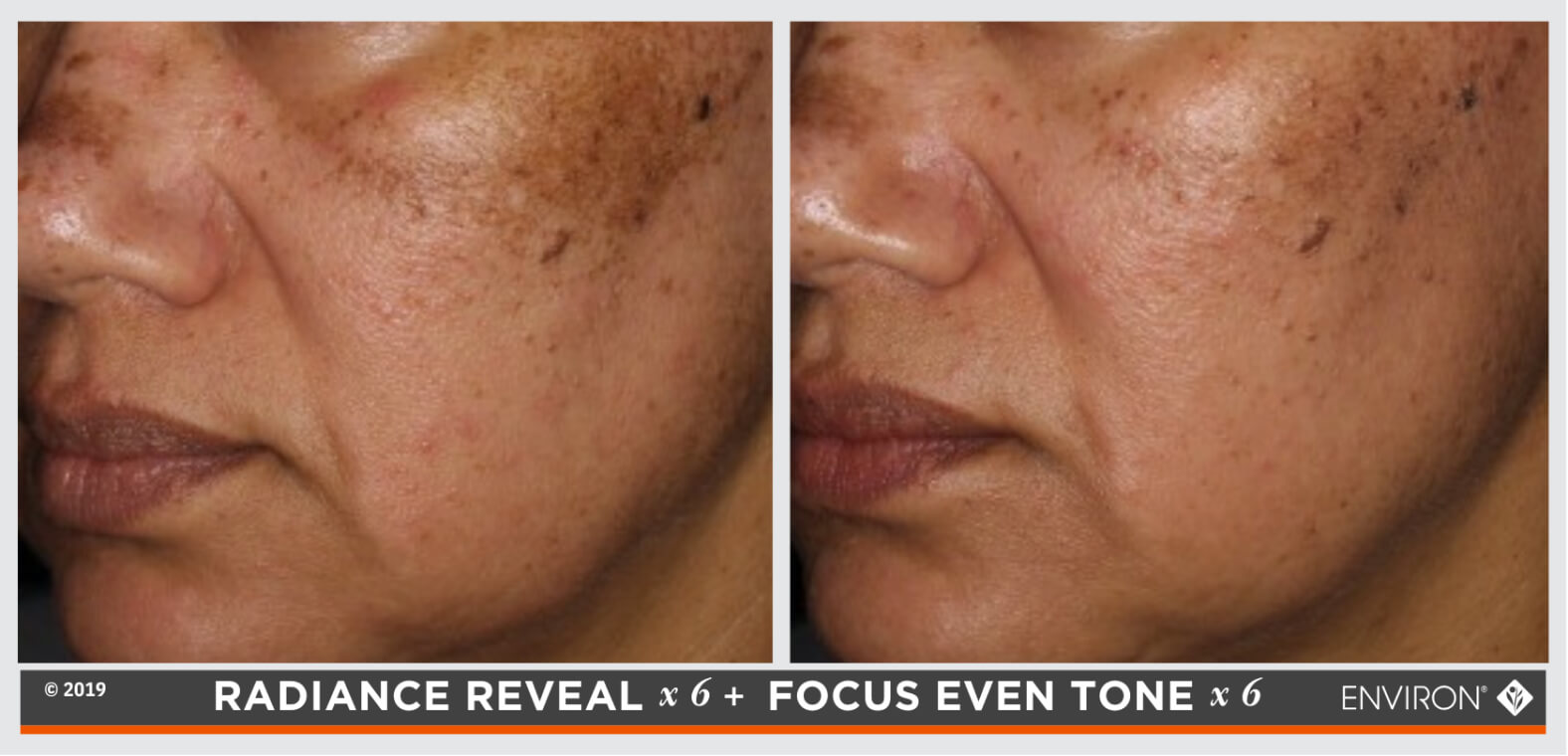 Environ® Electro-Sonic Ionzyme DF Machine III | Canada