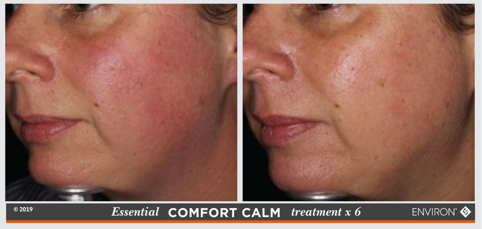 Environ® Electro-Sonic Ionzyme DF Machine III | Canada