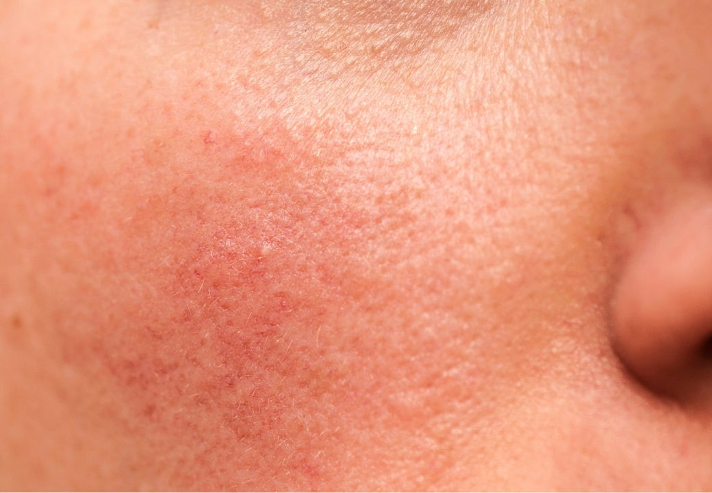 Brain-Skin Connection: Discover How Stress Speaks Through Your Skin ...